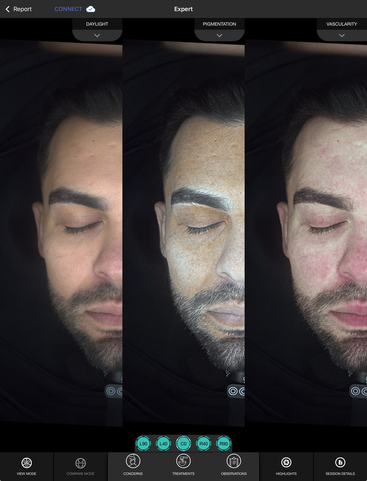 Skin Analysis Observ 520x – Dr Motox
